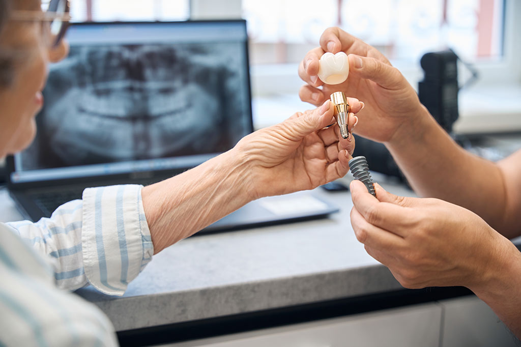 Single Tooth Dental Implant | Specialists in Implant Dentistry